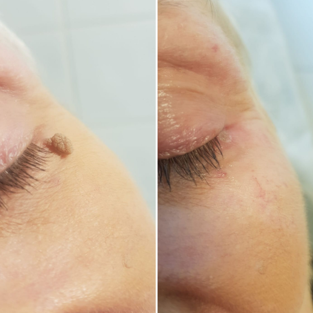 Skin Conditions – Mary Jeffrey