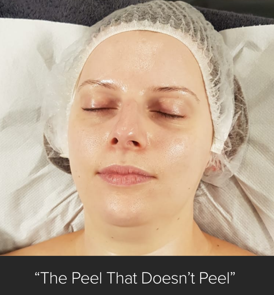 We’ve just finished our training! Unveiling the Environ TCA Cool Peel - MJ Beauty & Skin Clinic